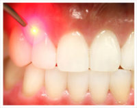 MANGO DENTAL - Best Dentist in Greensboro NC 336-275-4747